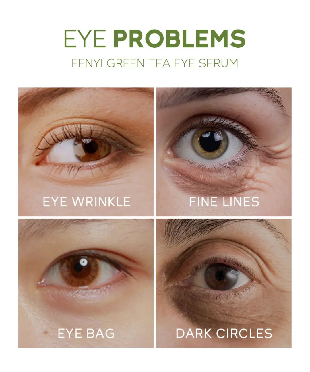 EYE CREAM – Vertex