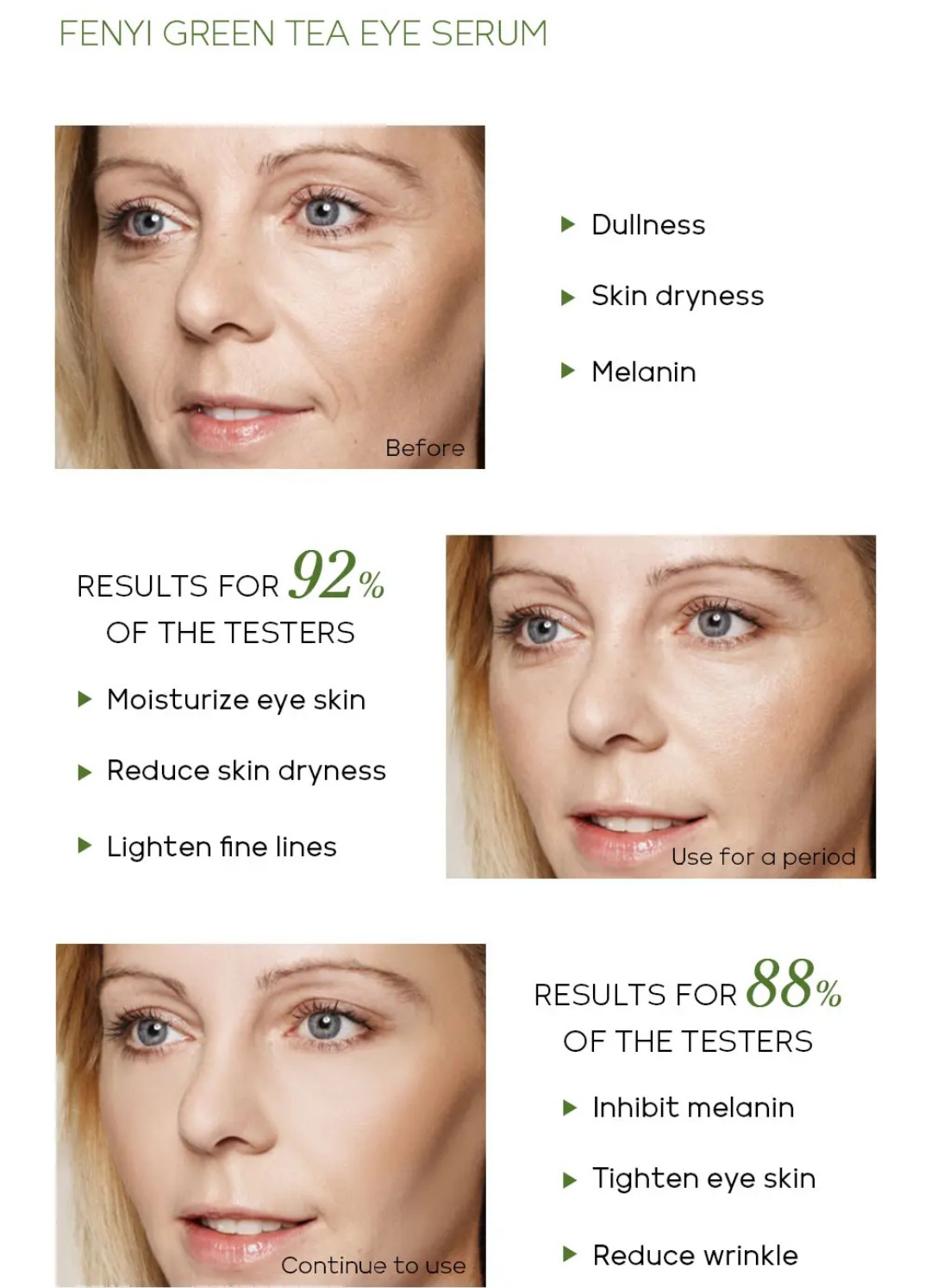 EYE CREAM – Vertex