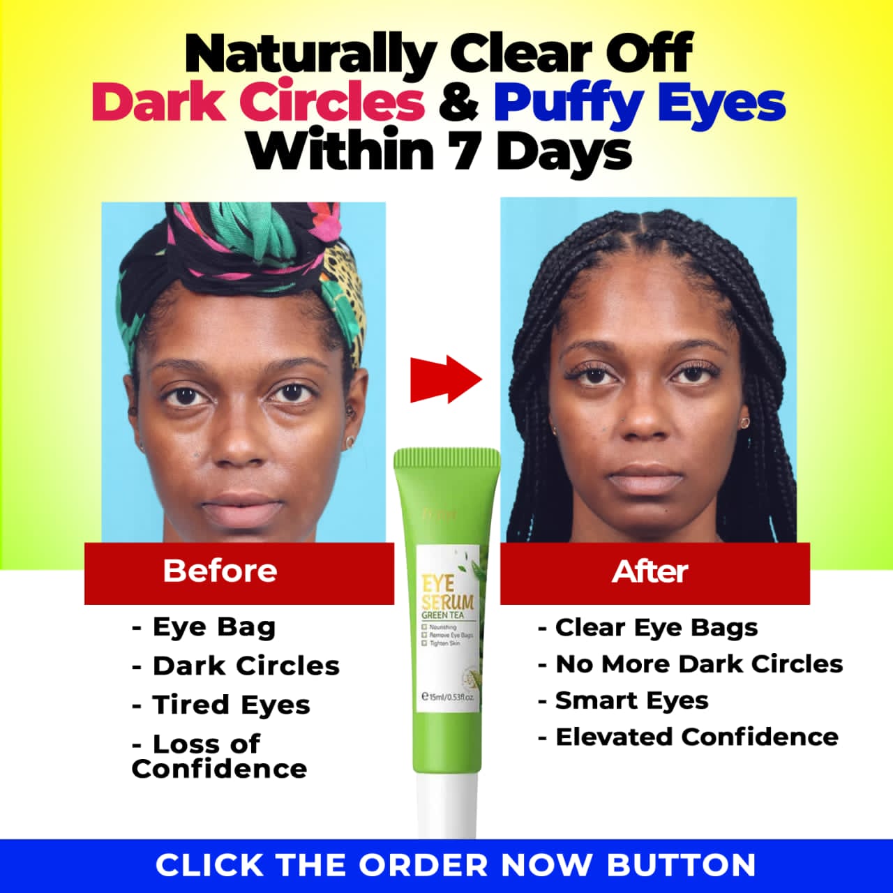 EYE CREAM – Vertex